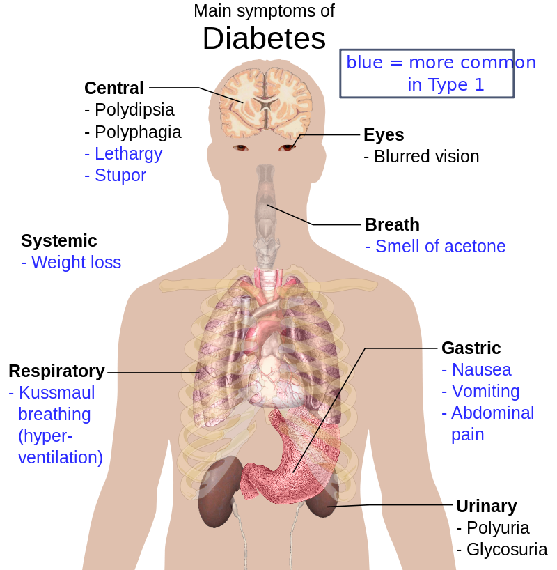 Difference Between Diabetes Mellitus And Diabetes Insipidus Pediaa Com