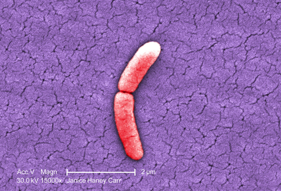 Difference Between Binary Fission and Mitosis – Pediaa.Com Difference Between Binary Fission and Mitosis – Pediaa.Com