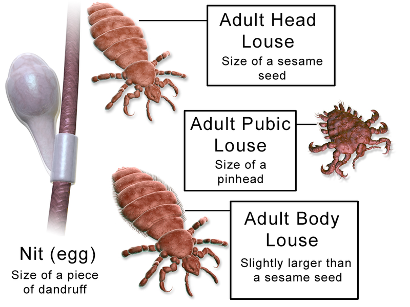 Difference Between Lice and Fleas - Pediaa.Com Difference Between Lice and Fleas - Pediaa.Com