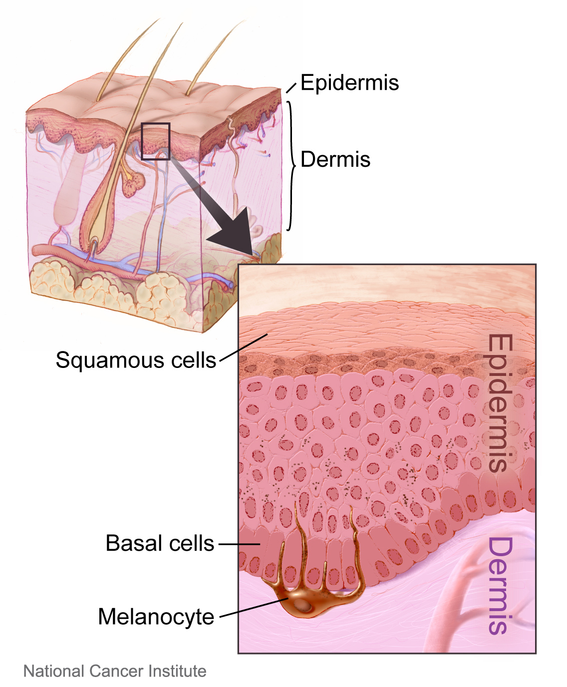 What Is The Difference Between Basal Cell And Squamous Cell Pediaa Com