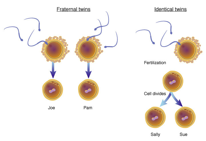 Difference Between Monozygotic and Dizygotic Twins | Definition, Cause ...