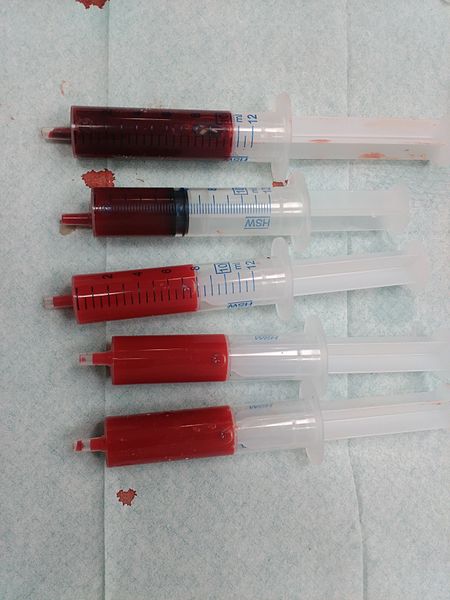 Difference Between Blood And Lymph Definition Components Function