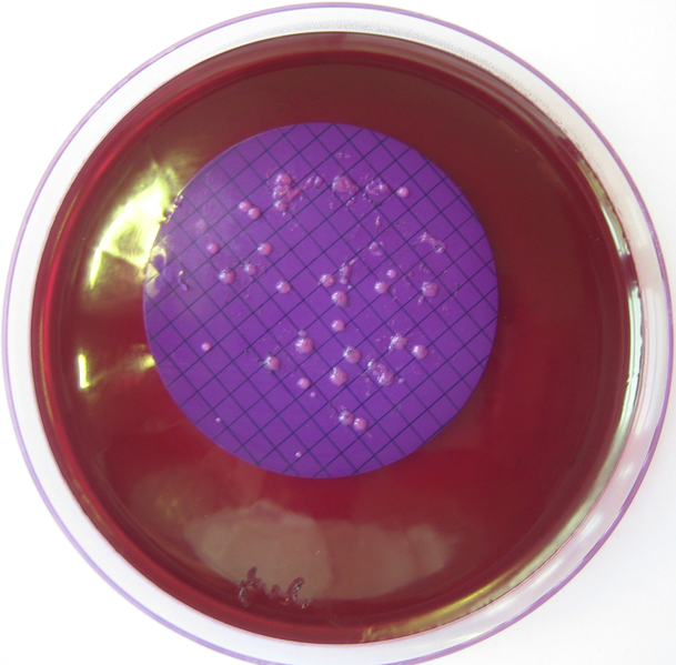 Difference Between Faecal and Non Faecal Coliforms - Pediaa.Com