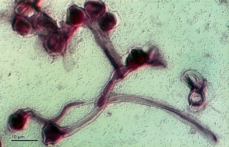 Difference Between Microspore and Pollen Grain - Pediaa.Com Difference Between Microspore and Pollen Grain - Pediaa.Com