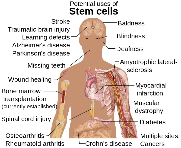 What Is The Difference Between Embryonic And Somatic Stem Cells