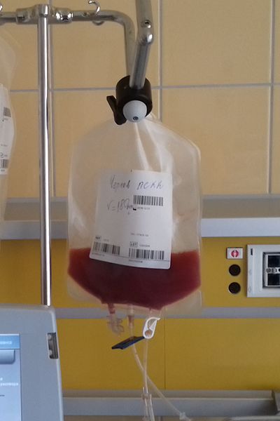 What is the Difference Between Stem Cell and Bone Marrow Transplant ...