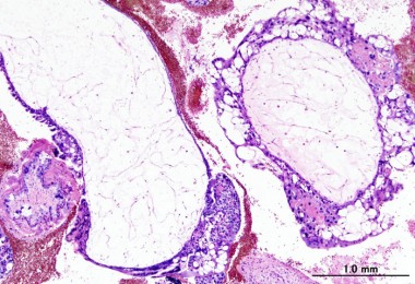 What is the Difference Between Complete and Partial Mole - Pediaa.Com