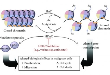 What is the Difference Between Histone and Nonhistone Protein - Pediaa.Com