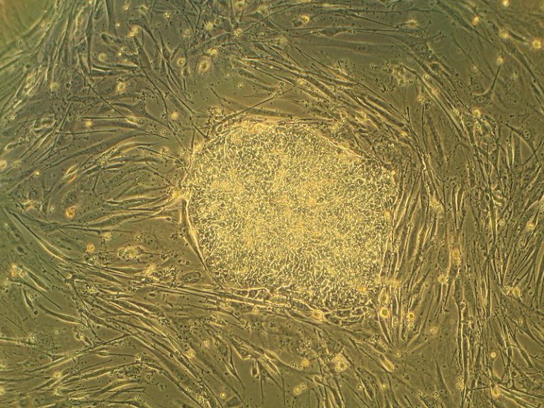 What is the Difference Between Finite and Continuous Cell Lines ... What is the Difference Between Finite and Continuous Cell Lines ...