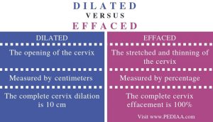 What is the Difference Between Dilated and Effaced - Pediaa.Com