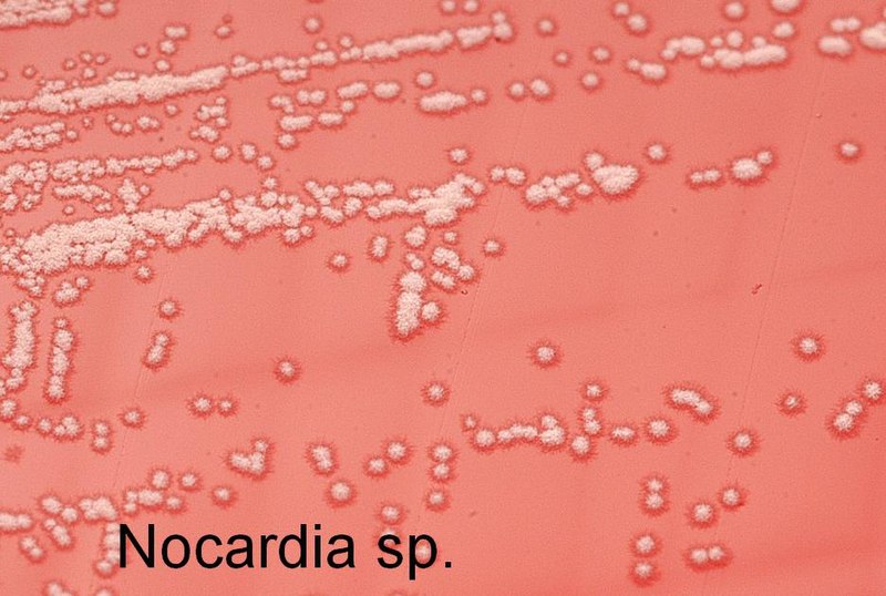 What is the Difference Between Nocardia and Actinomyces – Pediaa.Com