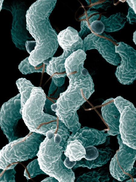 What is the Difference Between Campylobacter and Helicobacter - Pediaa.Com