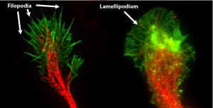 What is the Difference Between Lamellipodia and Filopodia - Pediaa.Com