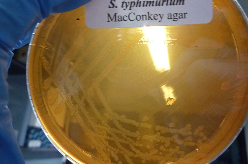 What is the Difference Between Salmonella Typhi O and H - Pediaa.Com