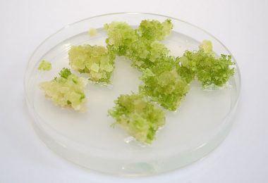 What is the Difference Between Endarch and Exarch - Pediaa.Com