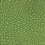 What is the Difference Between Candida Albicans and Candida Glabrata ...