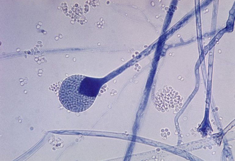 What is the Difference Between Conidia and Sporangiospores - Pediaa.Com