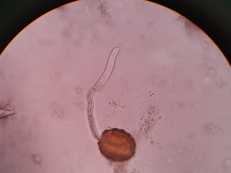 What is the Difference Between Ringworm and Roundworm - Pediaa.Com