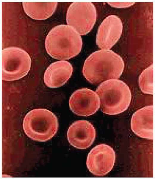What is the Difference Between Reticulocyte and Erythrocyte - Pediaa.Com