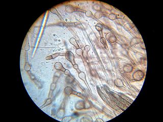 What is the Difference Between Paraphyses and Basidium – Pediaa.Com