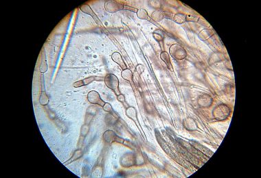 What is the Difference Between Paraphyses and Basidium - Pediaa.Com
