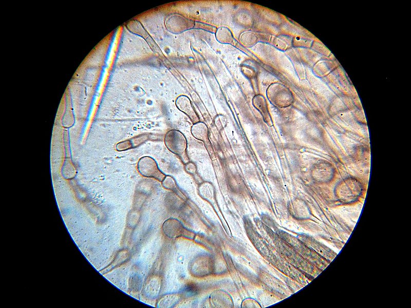 What is the Difference Between Paraphyses and Basidium – Pediaa.Com