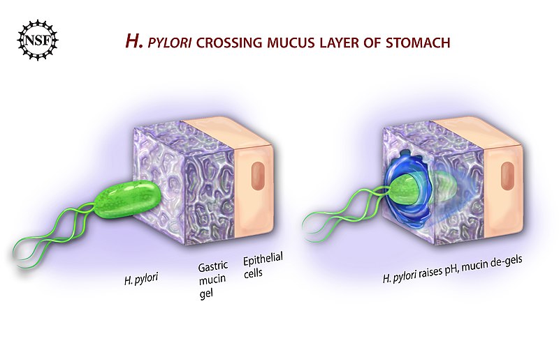 What is the Difference Between Helicobacter Pylori and Campylobacter ...