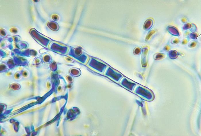 What is the Difference Between Microsporum Trichophyton and ...