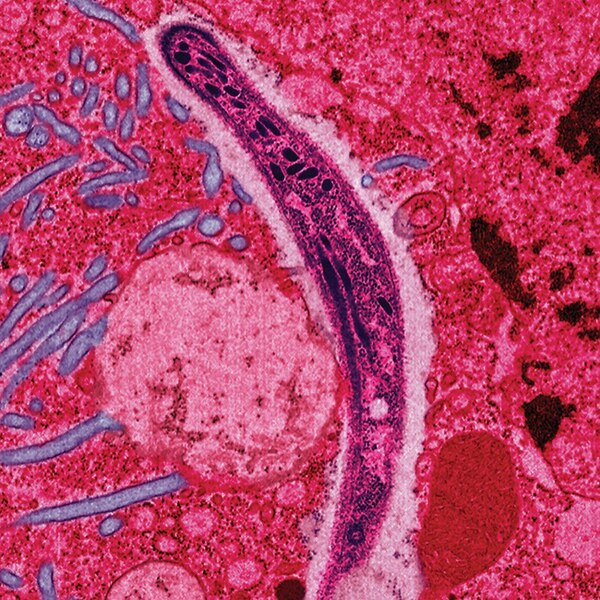 What is the Difference Between Plasmodium and Sporozoites - Pediaa.Com