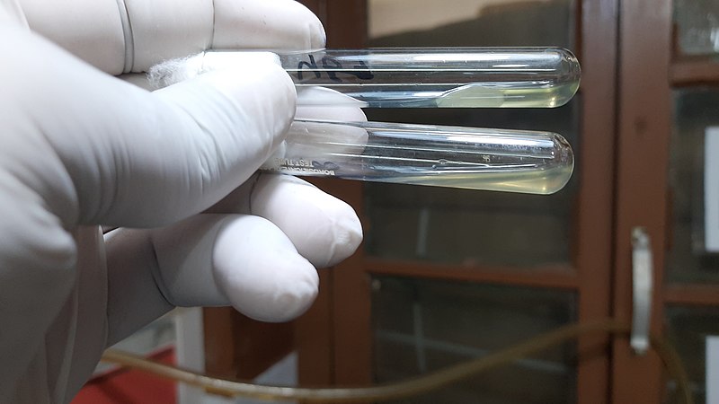 What Is The Difference Between Coagulase Negative And Positive Staphylococcus Pediaacom