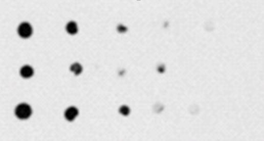 What is the Difference Between Dot Blot and Slot Blot - Pediaa.Com