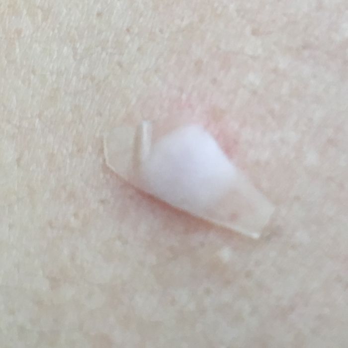What is the Difference Between Hydrocolloid and Hydrogel - Pediaa.Com