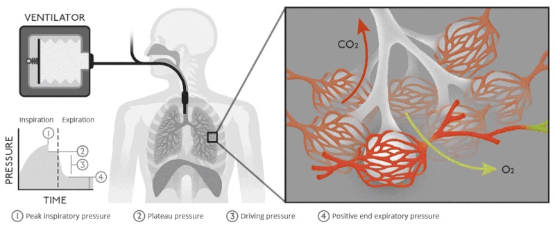 What is the Difference Between Ventilation and Perfusion - Pediaa.Com