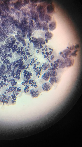 What is the Difference Between Diplotene and Diakinesis - Pediaa.Com