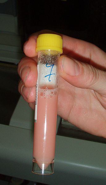 What is the Difference Between CSF and Mucus - Pediaa.Com